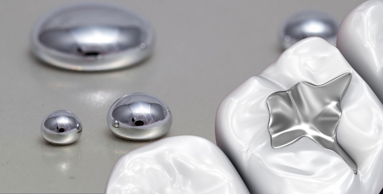 Retirada segura de empastes de amalgamas de plata